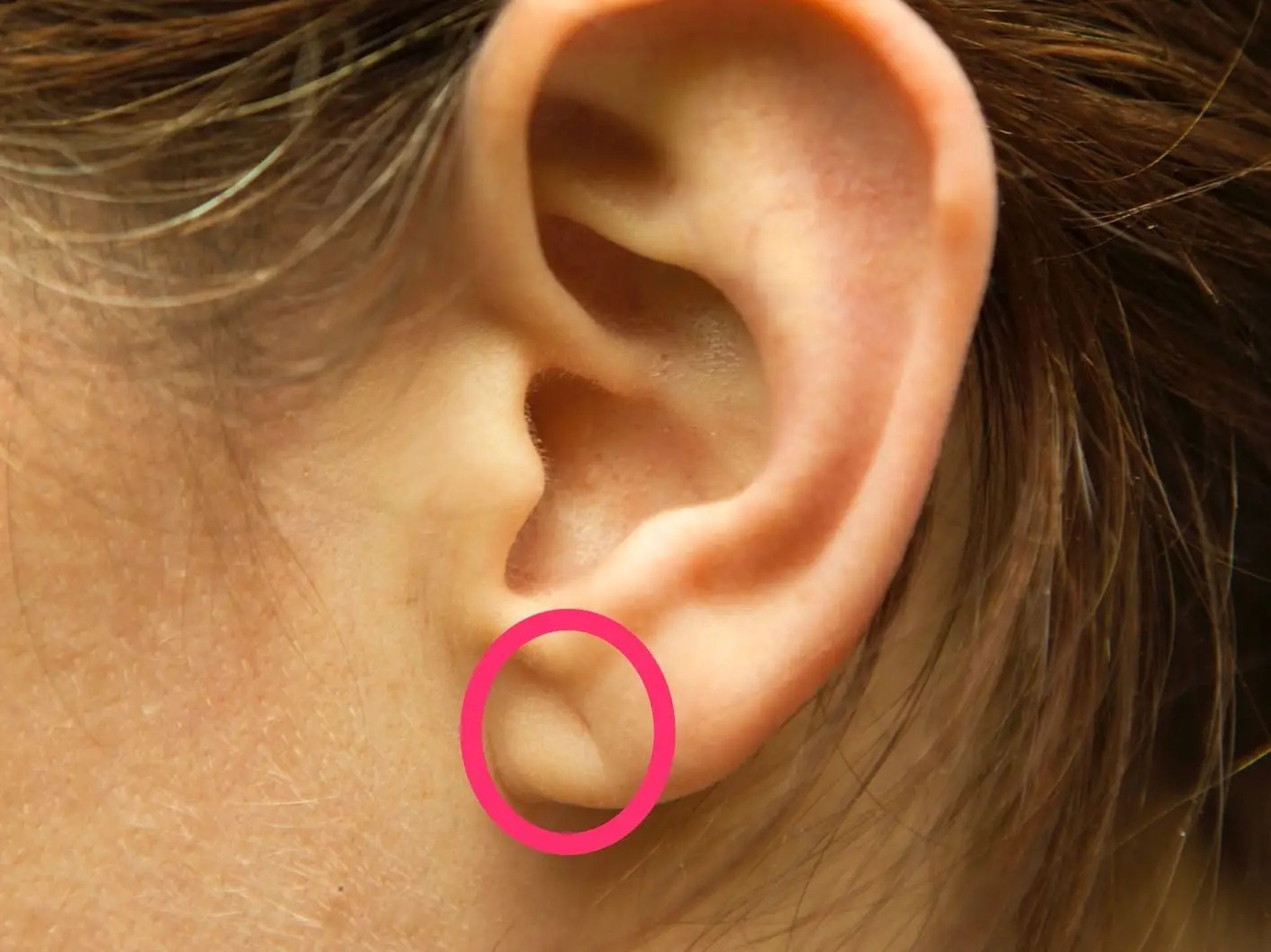 Un pliegue en el lóbulo de la oreja puede predecir enfermedades ...