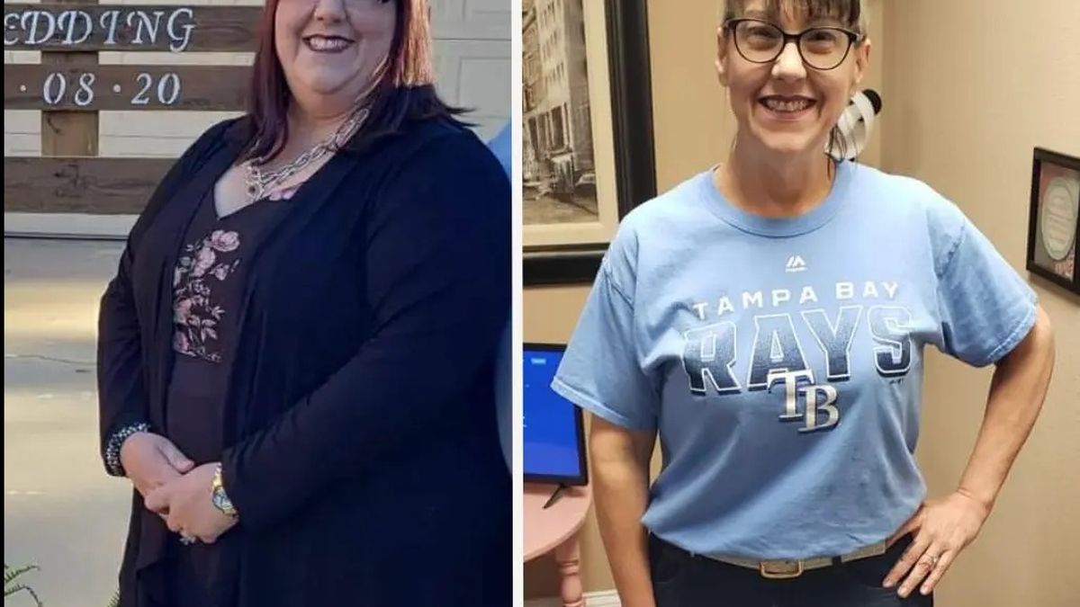 Una mujer perdió 80 kilos usando Mounjaro, el competidor de la ...